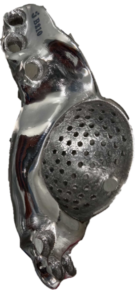 Custom Revision Hip Cage implant. - Jajal Medical Service