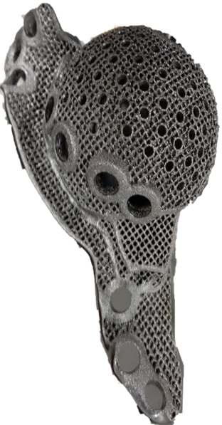 Custom Revision Hip Cage implant. - Jajal Medical Service