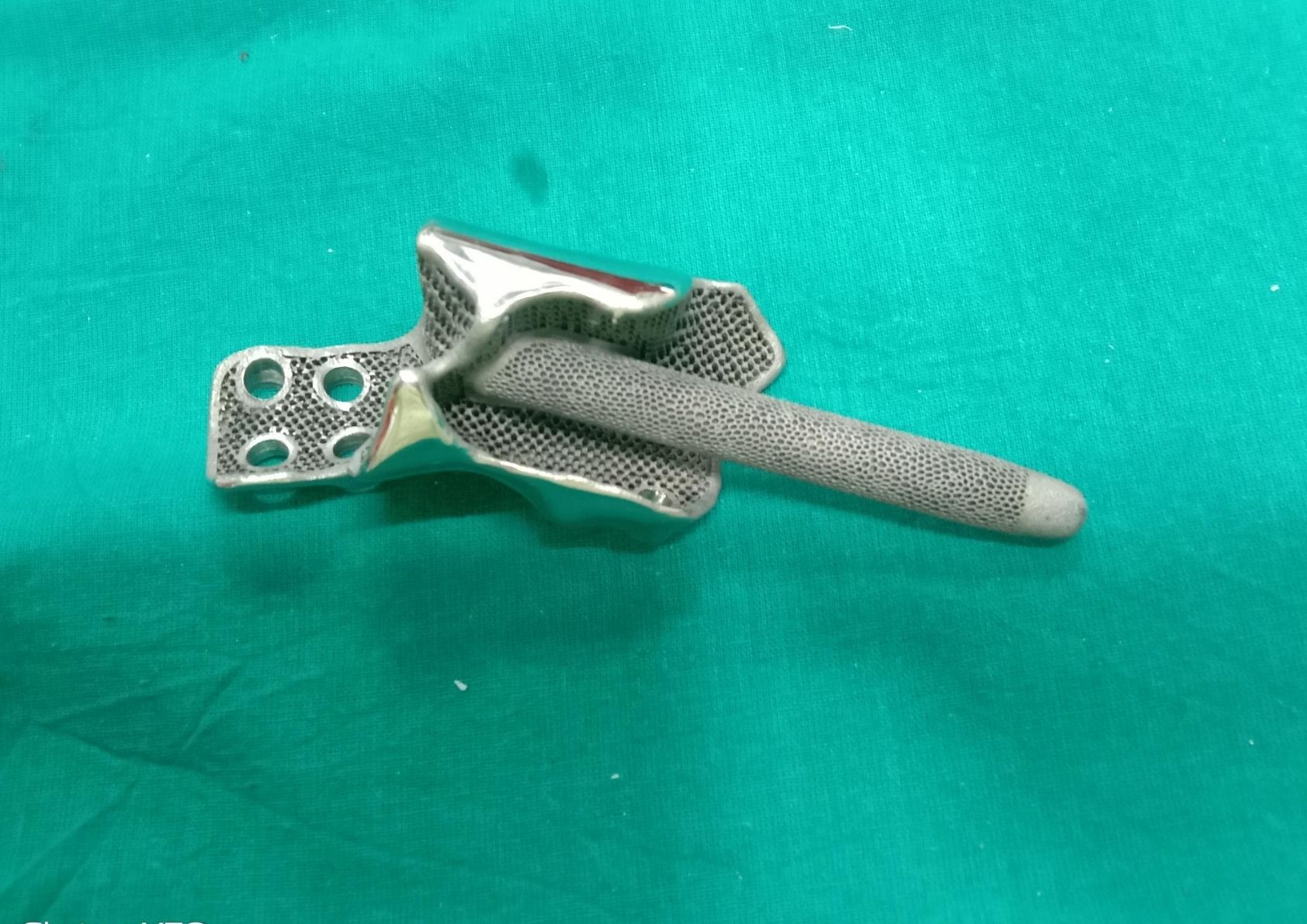 Custom Tibia Implant for Complex Tibial Reconstruction - Jajal Medical ...